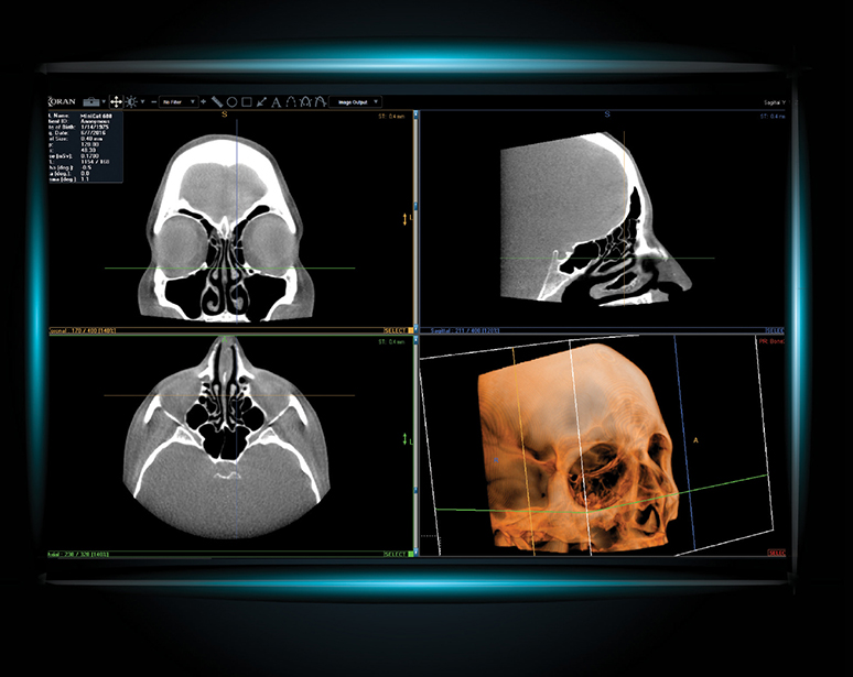 Advanced Imaging - Southern Arizona Ear Nose and Throat